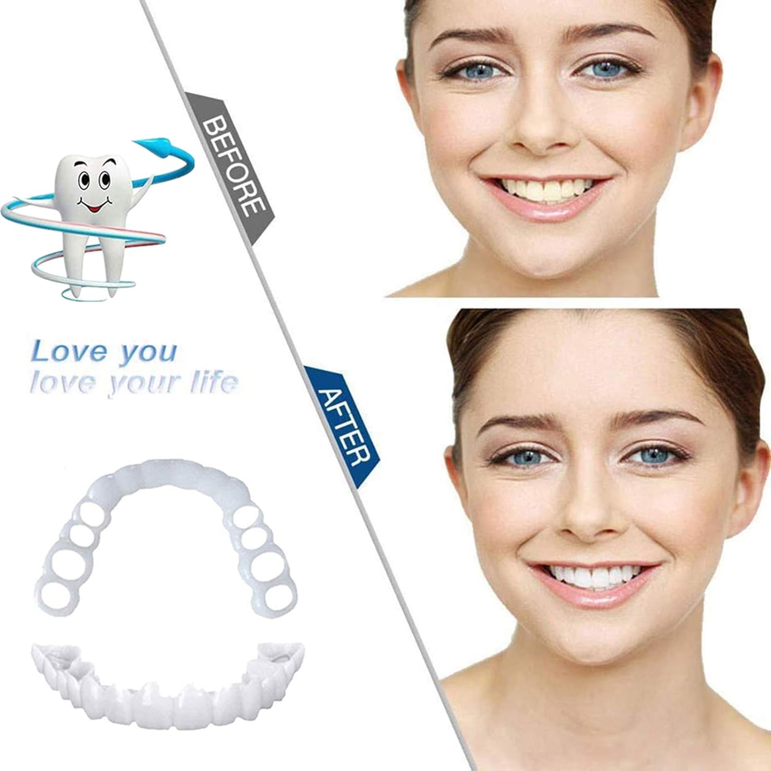 Magic Smile Teeth Brace – Mebior